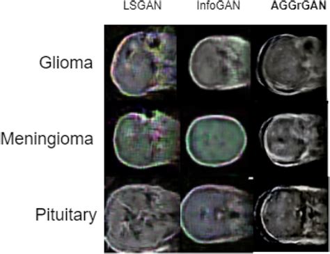 Visual Comparison Between Samples Images Generated By Existing Gan