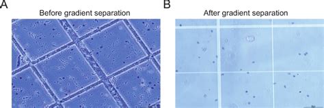 Nuclei Isolation From Fresh Frozen Brain Tumors For Single Nucleus Rna Seq And Atac Seq