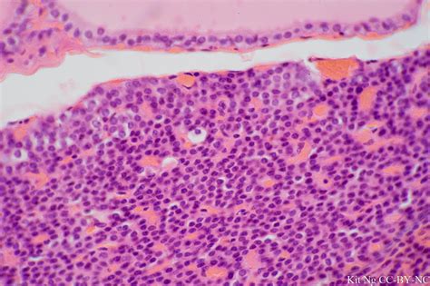 Parathyroid Microscope Slide