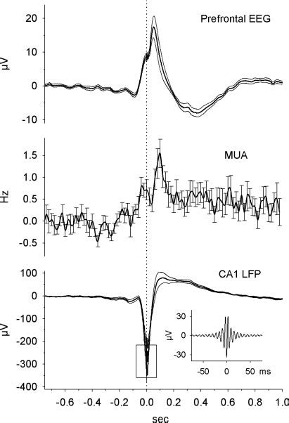 Sharp Wave Ripple Complex Averages Of Original Wideband Recorded Eeg