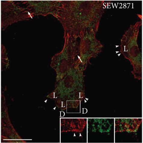 Cytoskeleton Organization And Cortactin Expression Bm Mscs Were Download Scientific Diagram