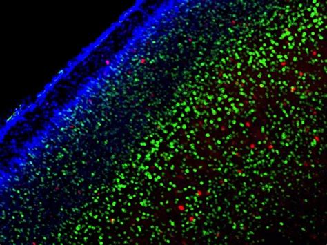 Excellent Immunostaining Of Cortical Neurons Biocompare Antibody Review