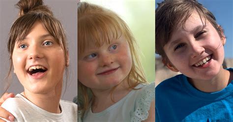 What Is Rett Syndrome Rett Revealed