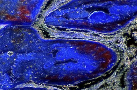 Spongy Bone Beginnings Hhmis Beautiful Biology