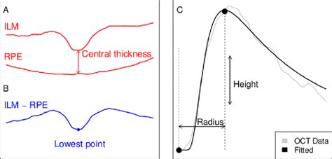 The Process Of Automatically Extracting Central Thickness Maximum Download Scientific Diagram