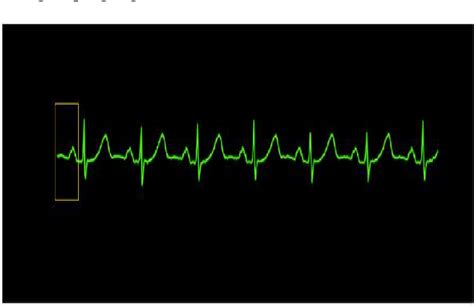 Figure 2 From Development Of Personalized Health Monitoring System Using Aws And Cloud Computing