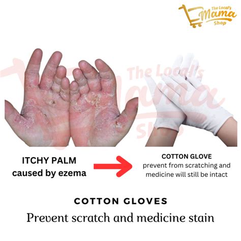 Eczema Gloves And Socks At Tyler Curr Blog