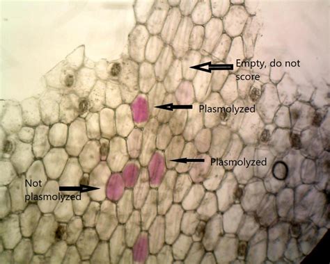 Solved Ignore Cells Devoid Of Any Color Plasmolysis Is The