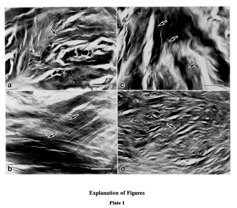 Figure 1 From Ultrastructure Of Collagen Fibers And Distribution Of Extracellular Matrix In The