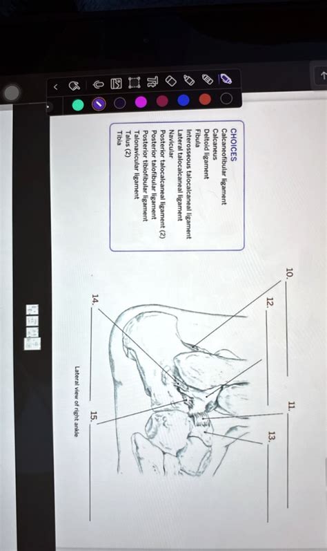 Choices Calcaneofibular Ligament Calcaneus Deltoid Ligament Fibula