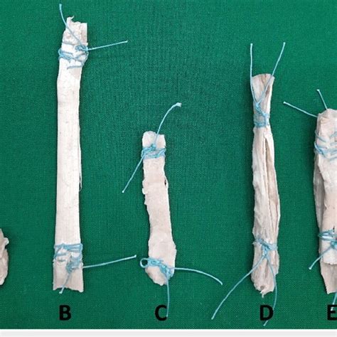 Tendon Grafts Harvested From Cadavers A Acl B Achilles Tendon Download Scientific Diagram