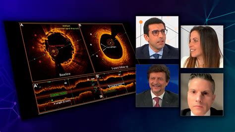 “bio Pci” The Turning Point Of Vascular Interventions