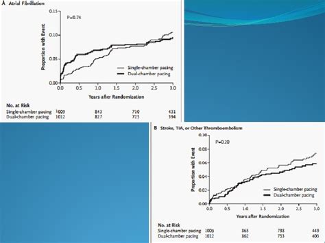 Mode Selection In Pacemaker Evidence Review Dr Shreetal