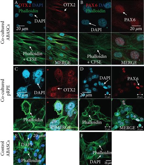 differentiation potential of abascs to retinal precursors cells a b