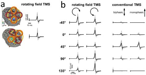 The Response Of Human Motor Cortex To RfTMS A The Cloverleaf Coil Is Download Scientific