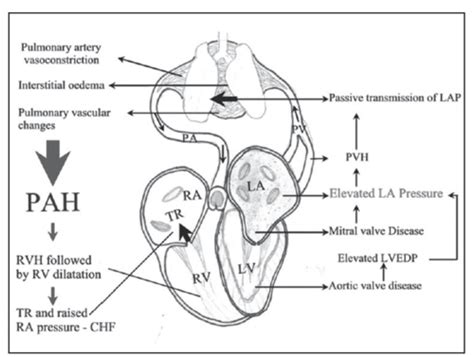 Pulmonary Htn Flashcards Quizlet