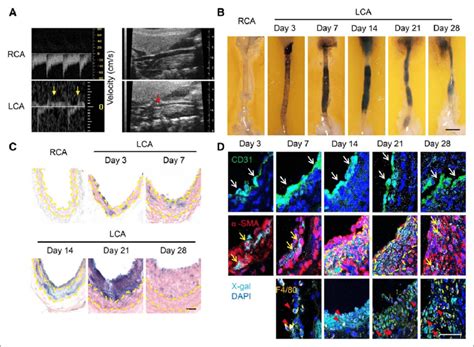 ccn1 expression was induced after ligation in normolipidemic mice ccn1