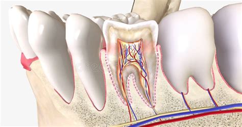 Sensitive Teeth Is A Common Dental Condition Characterized By Sharp