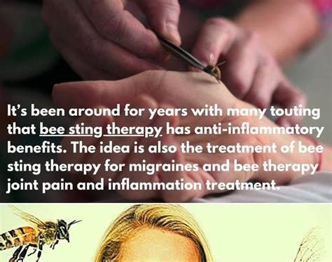 Bee Sting Therapy Serves As A Multivitamin