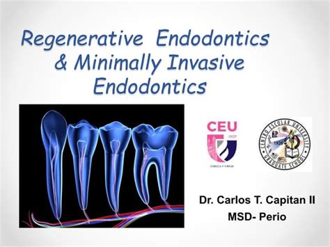 Regenerative Endodontics And Revascularization Pptx