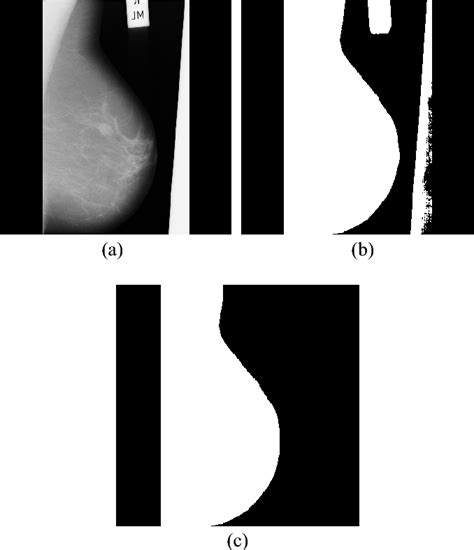 Figure From Feature Selection For Automatic Breast Density Classification Semantic Scholar