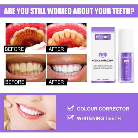 Teeth Whitening Paste™ 20 Tanden Kleur Corrector