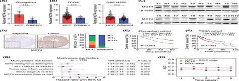 Monocarboxylate Transporter 4 Inhibition Potentiates Hepatoc Hepatology