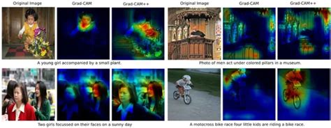 深度学习 Attention U Net（包含attention Gate代码） Csdn博客