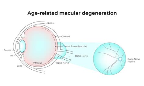 Degenerate Vectors And Illustrations For Free Download Freepik
