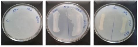 Inorganic Phosphate Solubilization Seen As Clear Zone Around The Colony Download Scientific