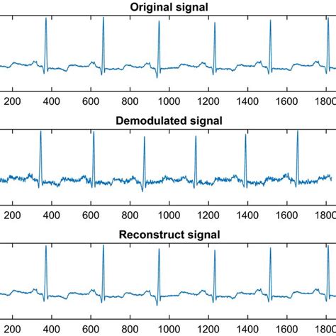 Signal During Compressive Sensing Technique Download Scientific Diagram