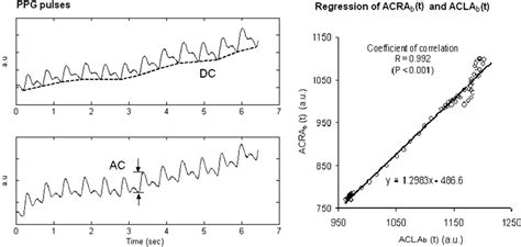 A Typical PPG Trace With DC And AC Components Identified B Highly Download Scientific