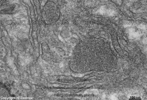 Lysosomes Drjastrows Electron Microscopic Atlas
