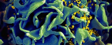 Scientists Have Removed HIV From Human Immune Cells Using A New Gene