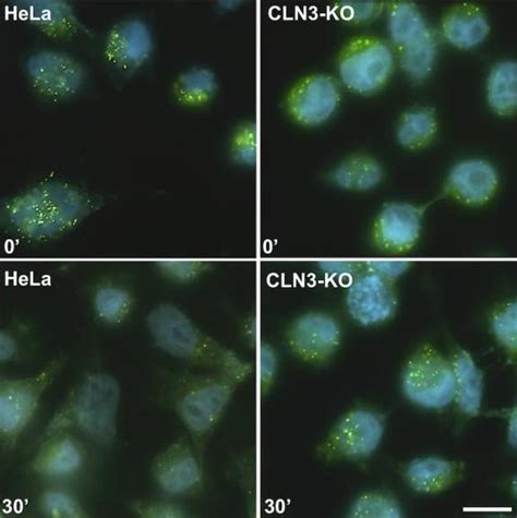 CLN3 protein [IMAGE] | EurekAlert! Science News Releases