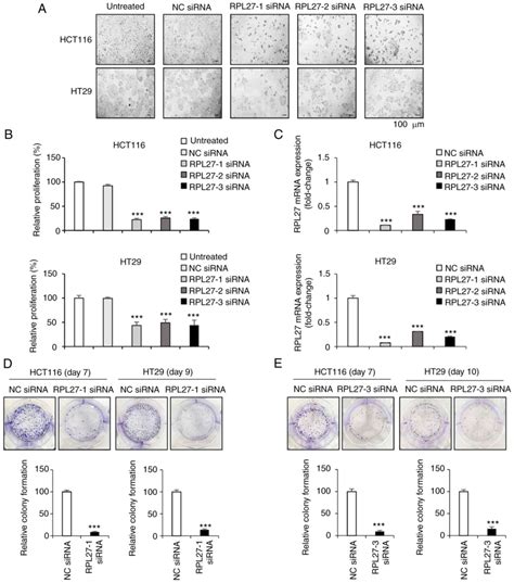 Rpl27 Contributes To Colorectal Cancer Proliferation And Stemness Via Plk1 Signaling