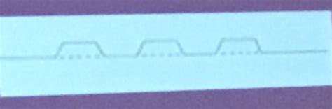 Ocular Flutter Flashcards Quizlet