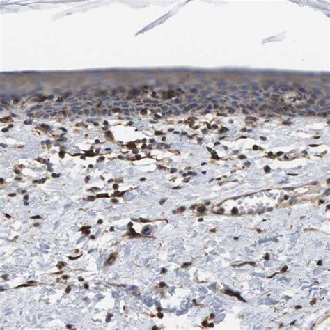 Rabbit Polyclonal Anti Bst2 Antibody Buy For Research Highly Specific Rigorously Validated