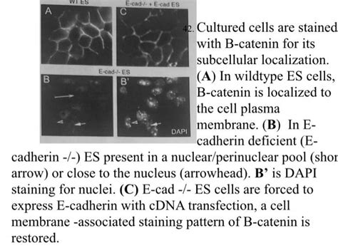 Solved Cultured Cells Are Stained With B Catenin For Its