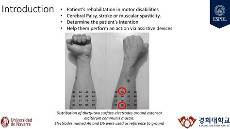 ⭐⭐⭐⭐⭐ Emg Signal Processing With Clustering Algorithms For Motor