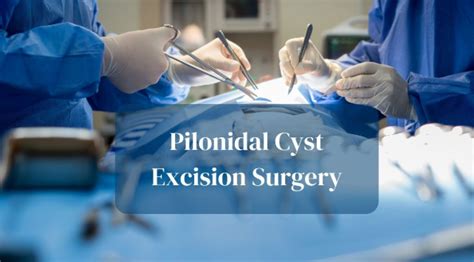 Aftercare Tips For Pilonidal Cyst Excision Surgery Wealth Behind The Fame