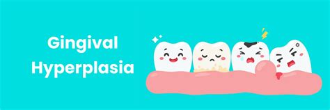 Hiperplasia Gingival