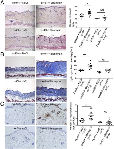 Mice Lacking Ox40l Are Protected From Dermal Fibrosis Induced By