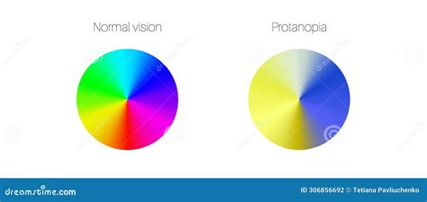 Protanomaly And Protanopia Stock Vector Illustration Of Diagram