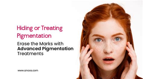 Pigmentation Treatment Hiding Or Treating Pigmentation