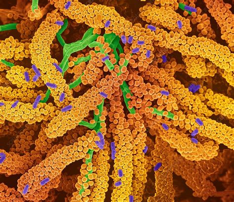 Streptococcus Bacteria Sem Stock Image C026 7496 Science Photo Library