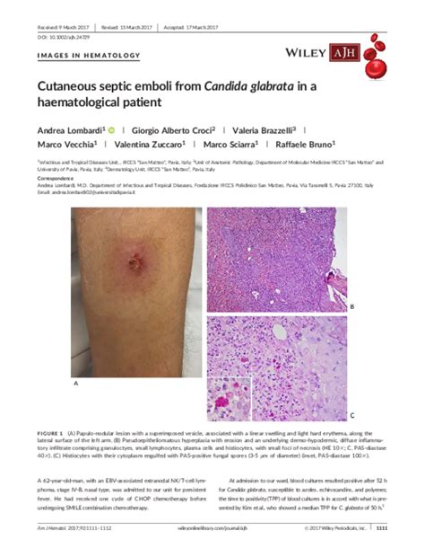 Pdf Cutaneous Septic Emboli From Candida Glabrata In A Haematological