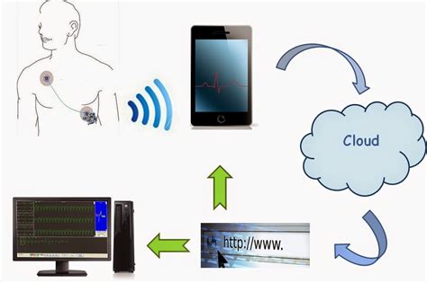 Iot Contest Mini Ecg Blogs Nordic Blog Nordic Devzone