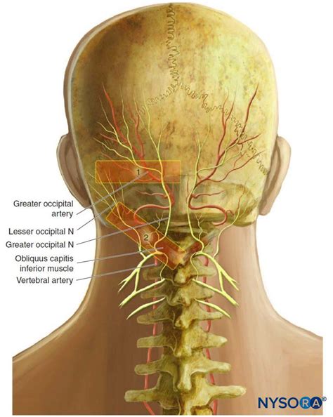 Occipital Nerve Block Injection Ttoqx