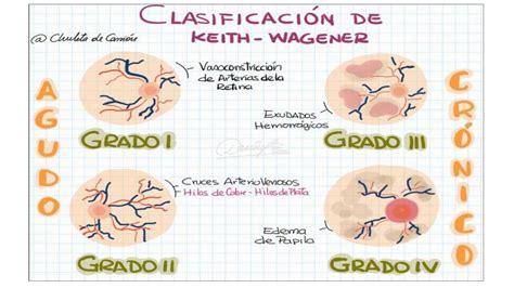 ClasificaciÓn De Keith Y Wegener Principales CaracterÍsticas La